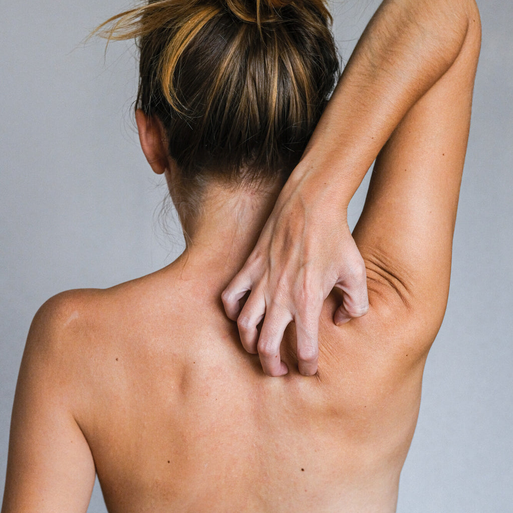 10 Tips for Dealing With Chafing Skin as a Runner – Squirrel's Nut Butter